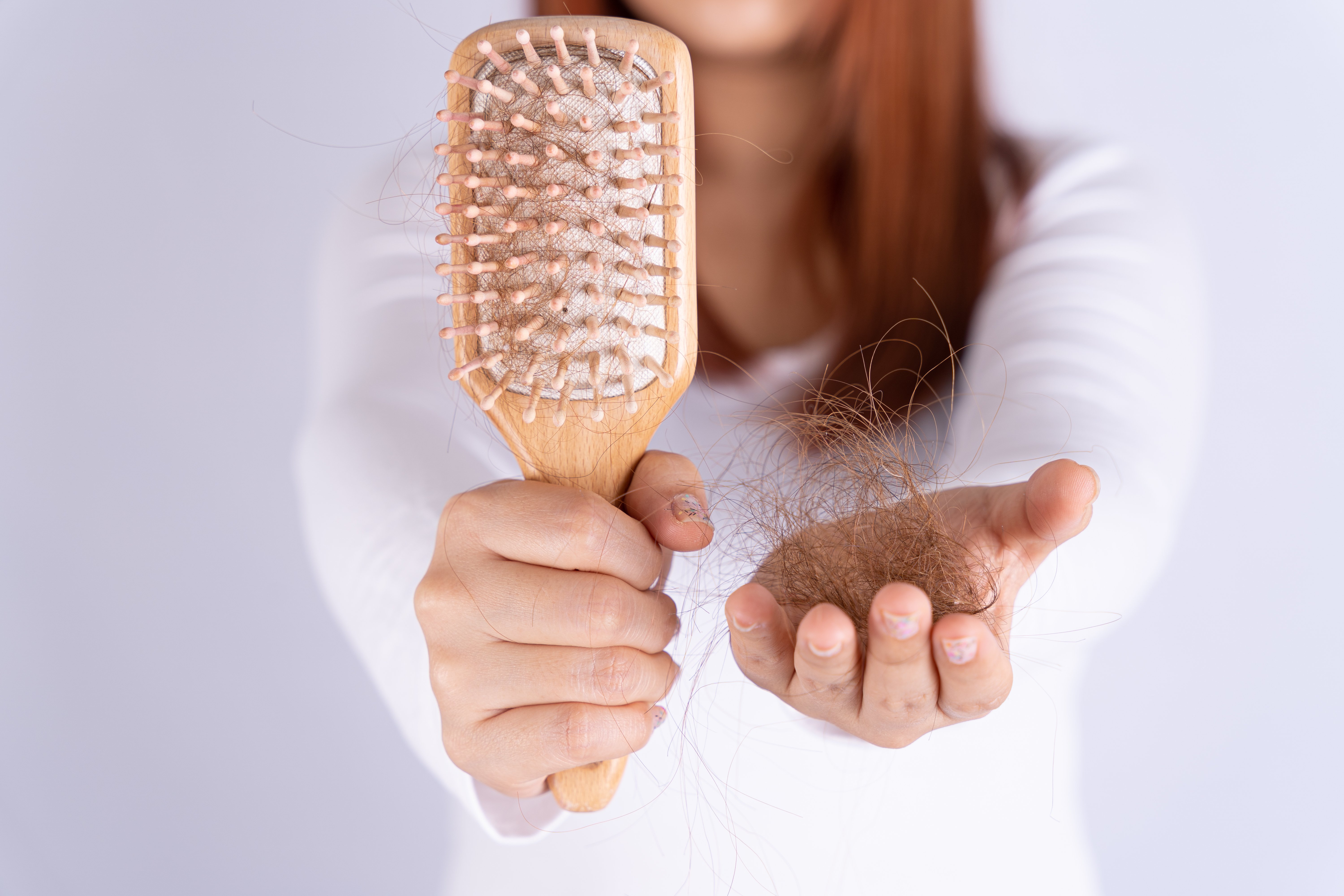 ¿Por qué se cae el cabello?: motivos y tratamientos